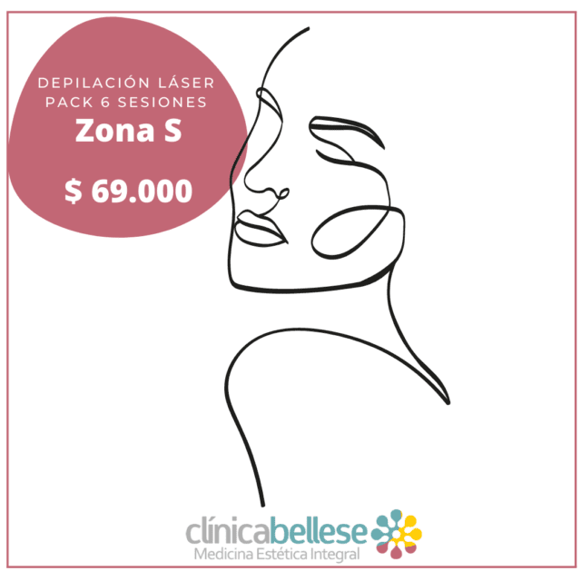 Pack 4: 6 sesiones depilación Láser: Rostro completo + Piernas ...